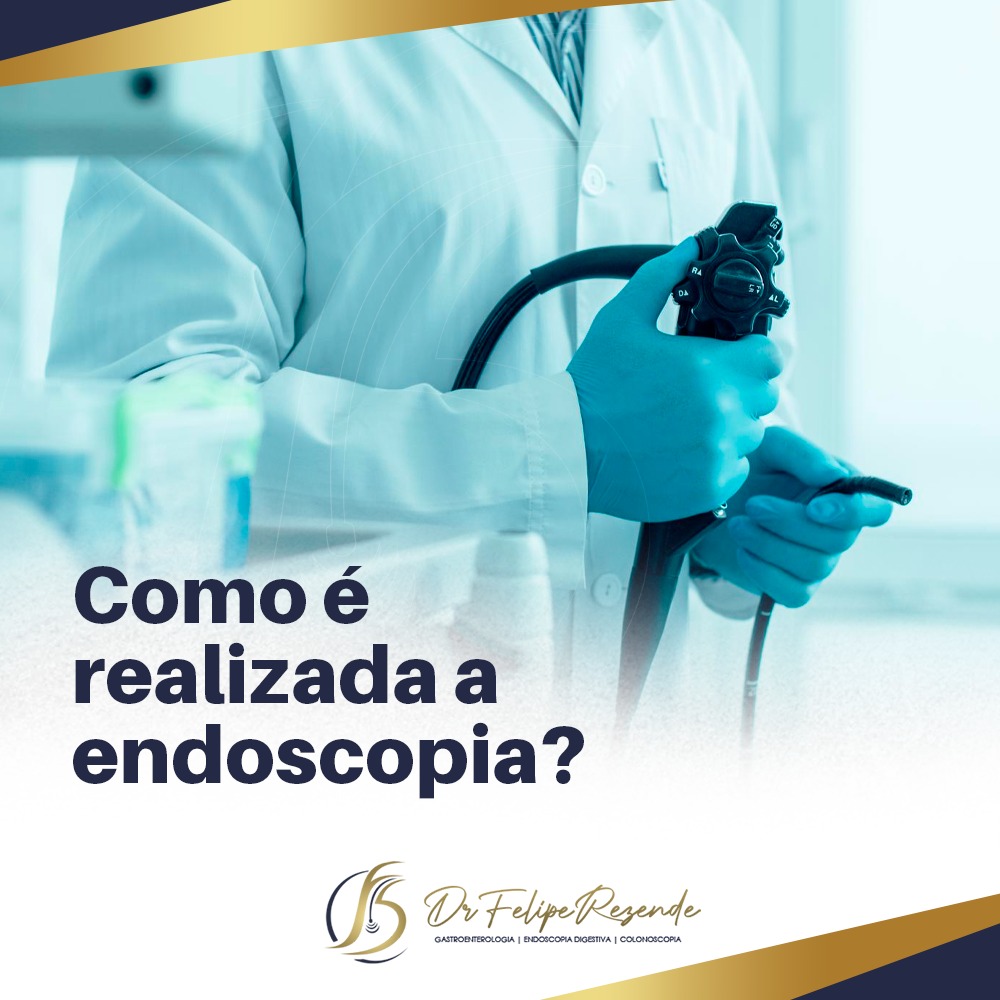 Dr. Felipe Rezende | Blog | Como é realizada a colonoscopia?